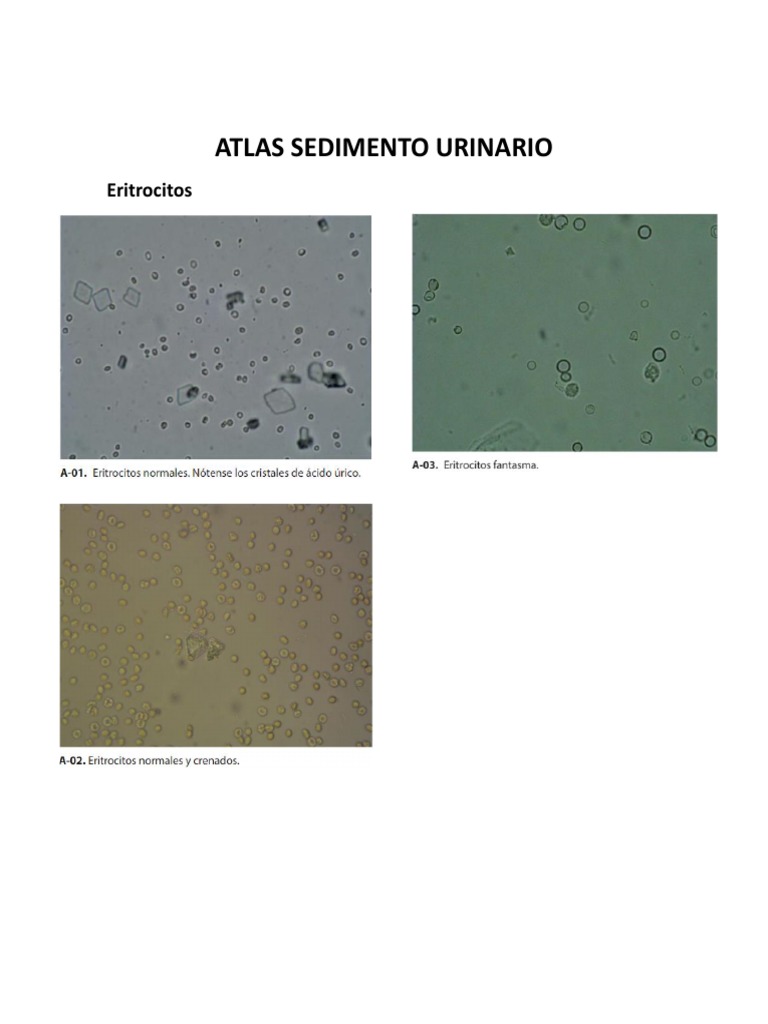 ATLAS SEDIMENTO URINARIO (Laboratorio Clínico) | PDF