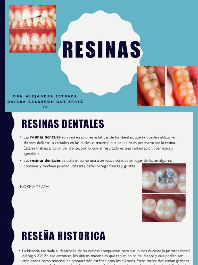 Resinas Dentales: Composición y Aplicaciones | PDF | Polimetacrilato de ...