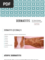 Dyshidrotic Eczema (Pompholyx, Vesicular Hand Eczema) - DermNet | PDF ...