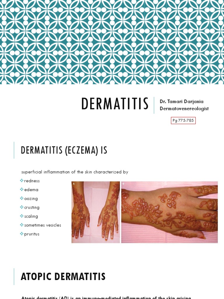 Dermatitis | PDF | Dermatitis | Allergy
