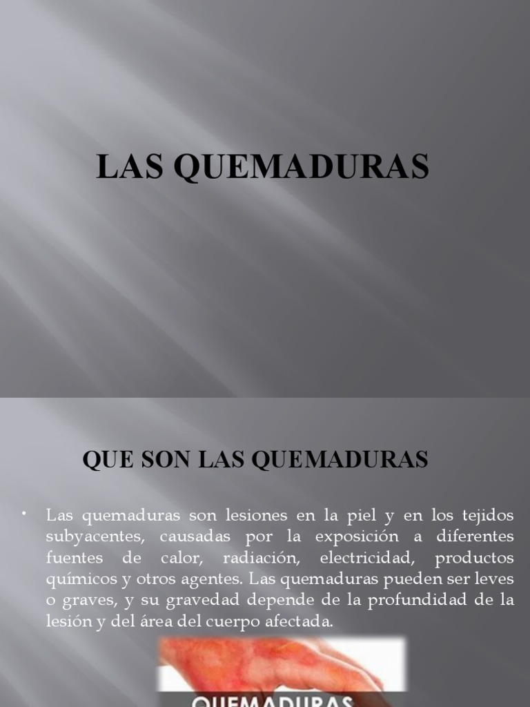 Primeros Auxilios para Quemaduras | PDF | Quemar | Primeros auxilios
