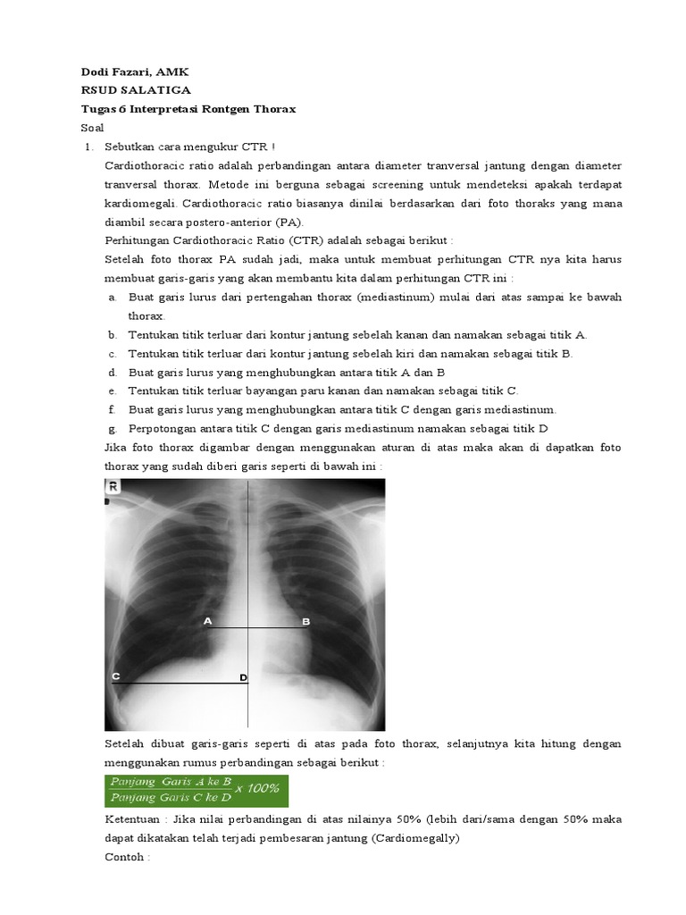 Tugas 6 Interpretasi Rontgen Thorax | PDF