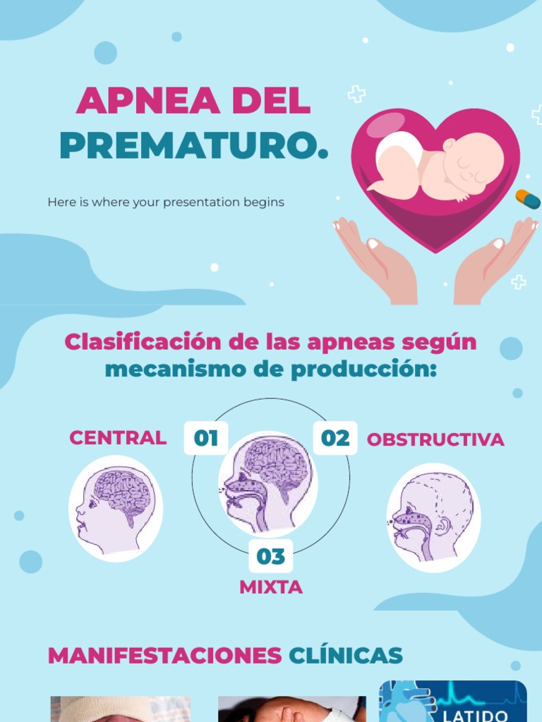 Apnea Del Prematuro | PDF