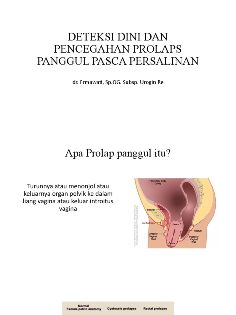 Deteksi Dini Dan Pencegahan Prolaps Panggul Pasca Persalinan | PDF