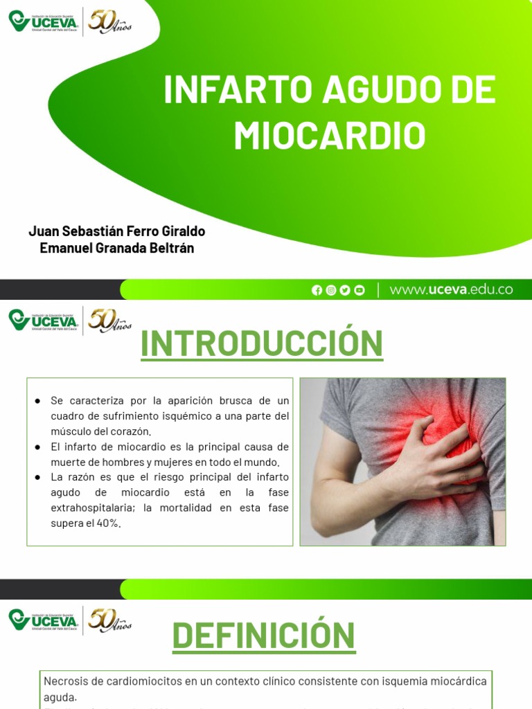 Infarto Agudo de Miocardio | PDF | Infarto de miocardio | Isquemia