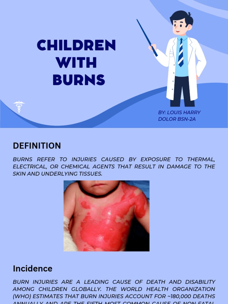 BURNS | PDF | Burn | Injury