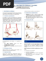 Clasificacion de Frykman | PDF