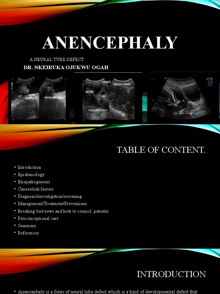 Anencephaly 1 PPTX | PDF | Human Diseases And Disorders | Medical ...