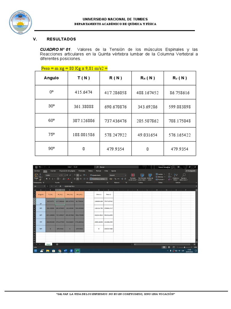 Practica #04 Columna Vertebral | PDF