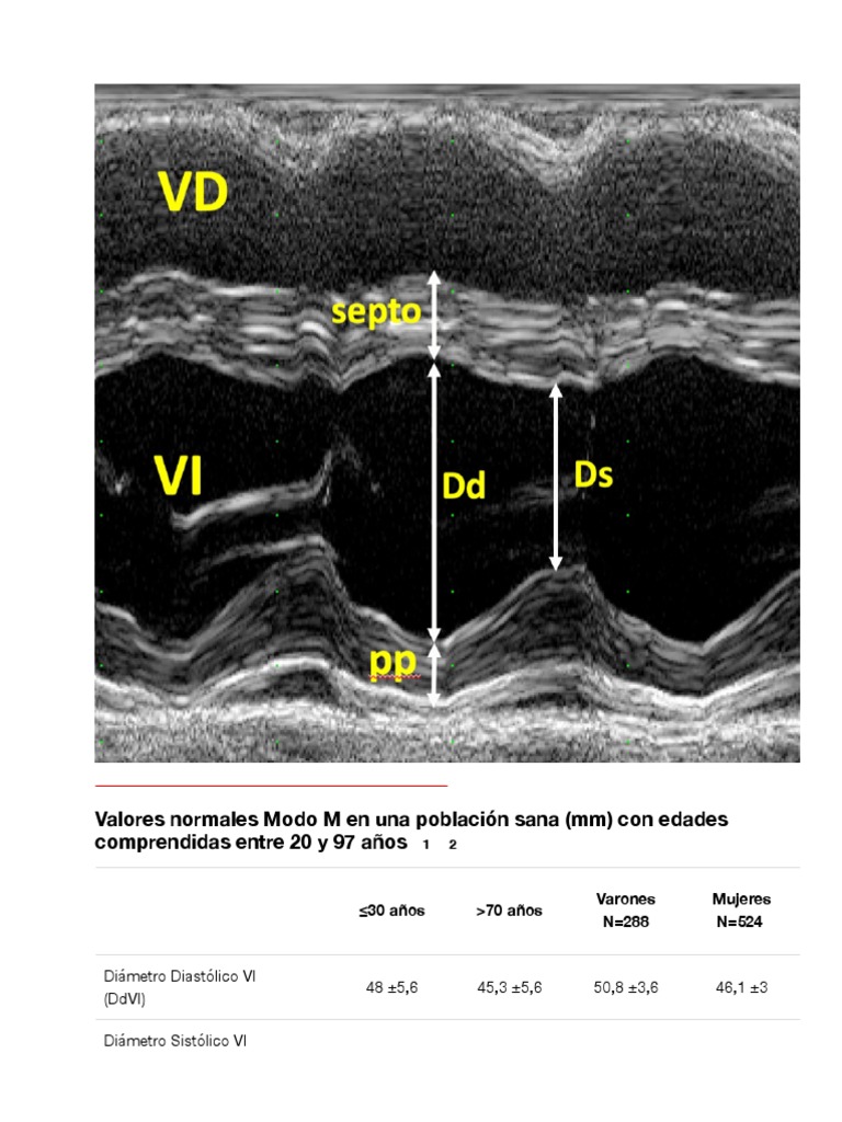 Ecocardiografía Modo M | PDF | Anatomía humana | Anatomía