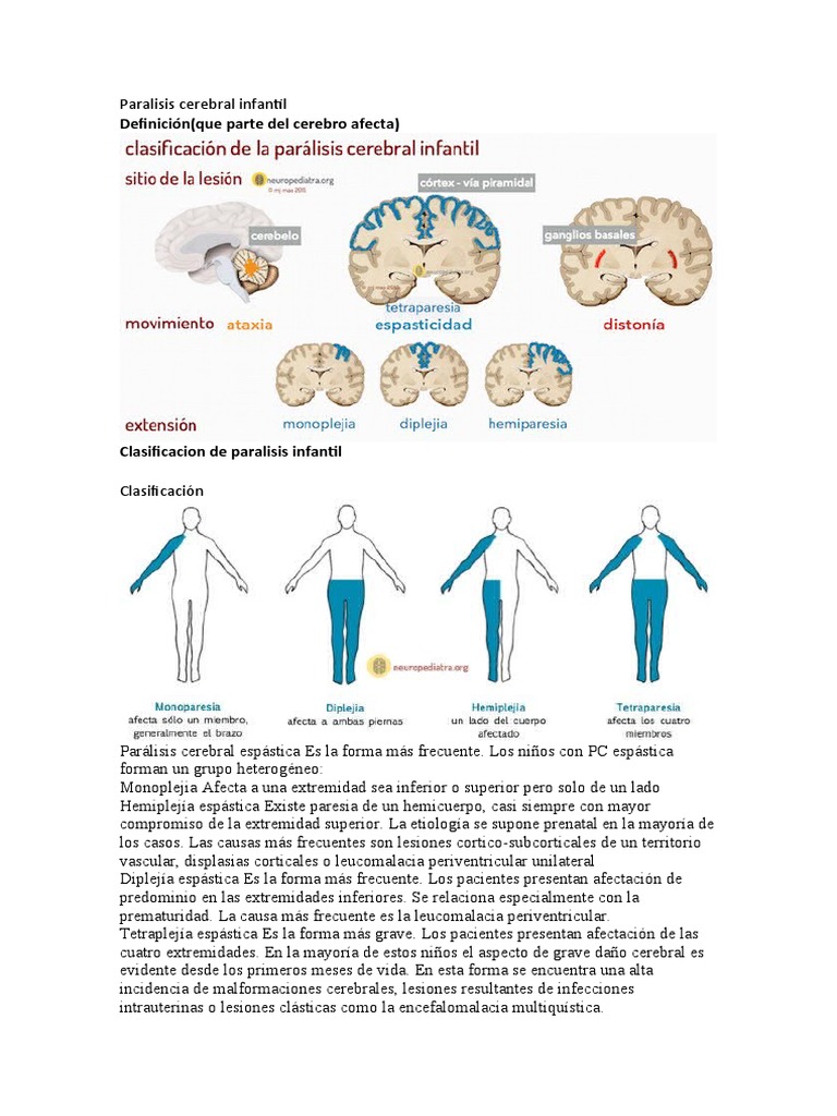 Clasificación de la Parálisis Cerebral Infantil | PDF | Parálisis ...