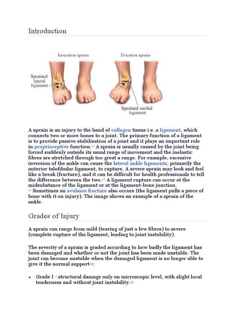 Ligament Sprain | PDF