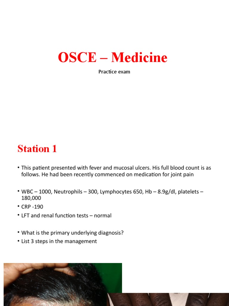 Practice OSCE | Download Free PDF | Cardiopulmonary Resuscitation ...