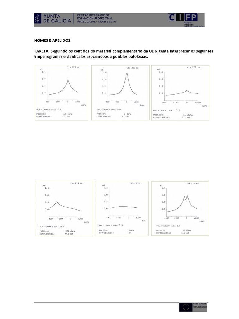 Ta6 1 1 Curvas Timpanometricas | PDF