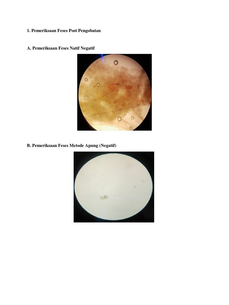 Pemeriksaan Feses, Hematologi, Ulas Darah Dan Cacing | PDF
