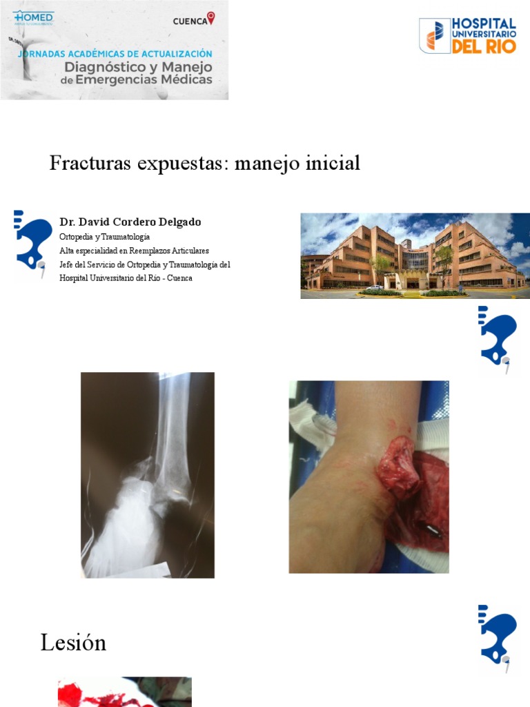Manejo De Las Fracturas Expuestas – FHSKM