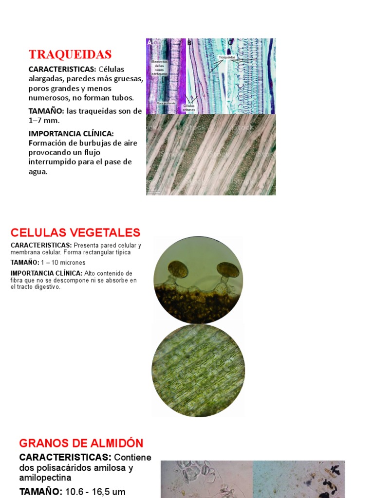 TRAQUEIDAS | PDF | Digestión | Heces