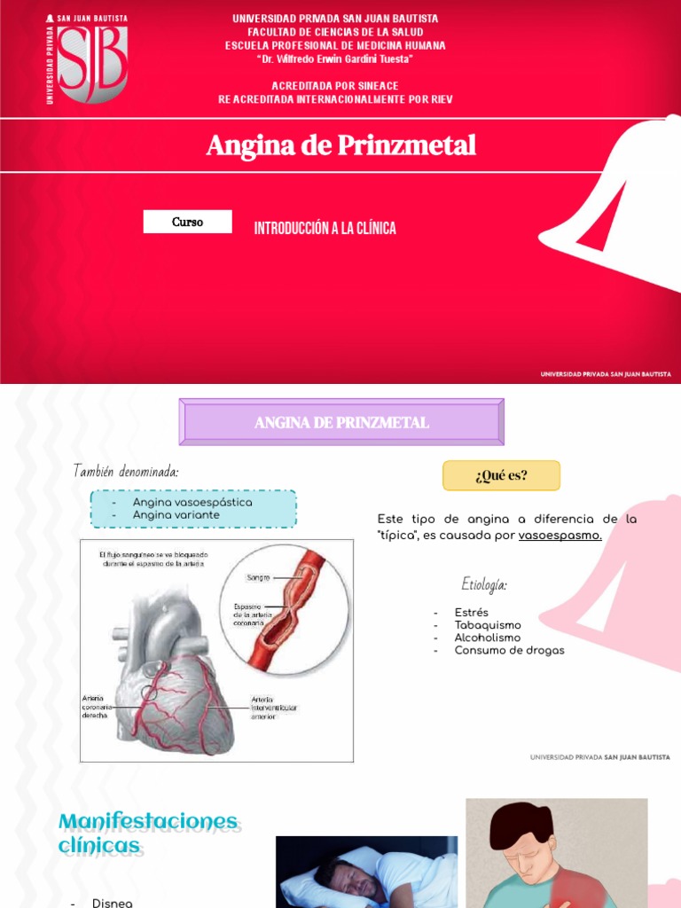 Angina de Prinzmetal | PDF