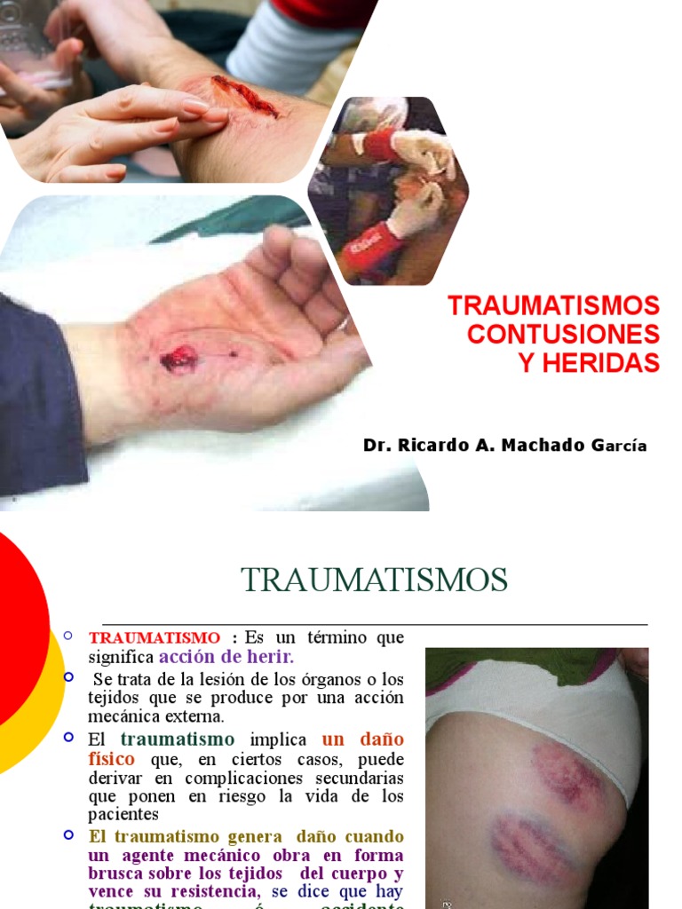 Traumatismos, Heridas y Contusiones | PDF | Lesión | Herida