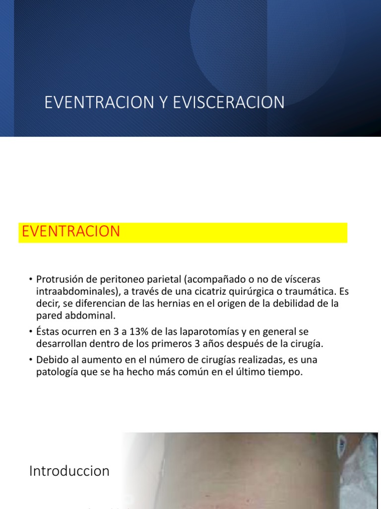 9 Eventracion y Evisceracion | PDF | Cirugía | Cáncer