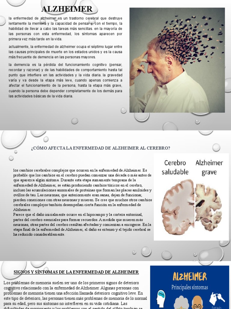 Alzheimer | PDF | Enfermedad de Alzheimer | Cerebro