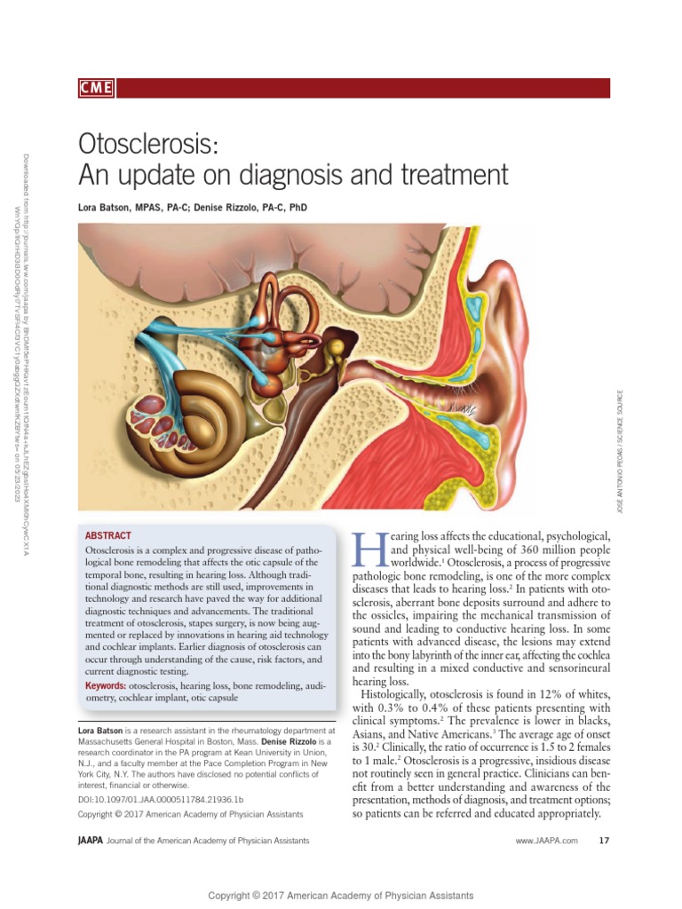 Otosclerosis An Update On Diagnosis and Treatment.3 | PDF | Hearing ...