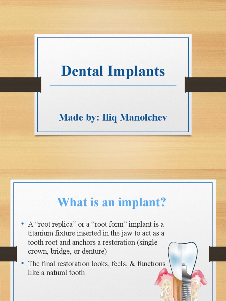 Dental Implants | PDF