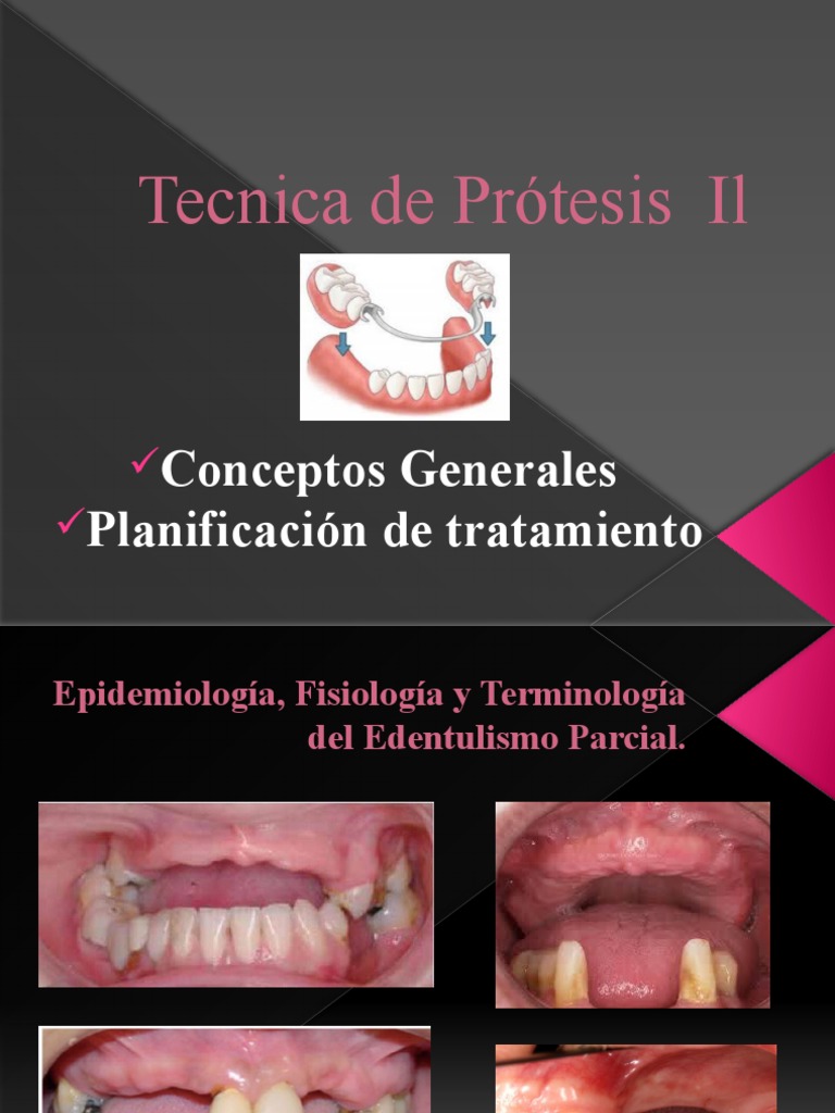1 Prótesis Conceptos Generales | PDF