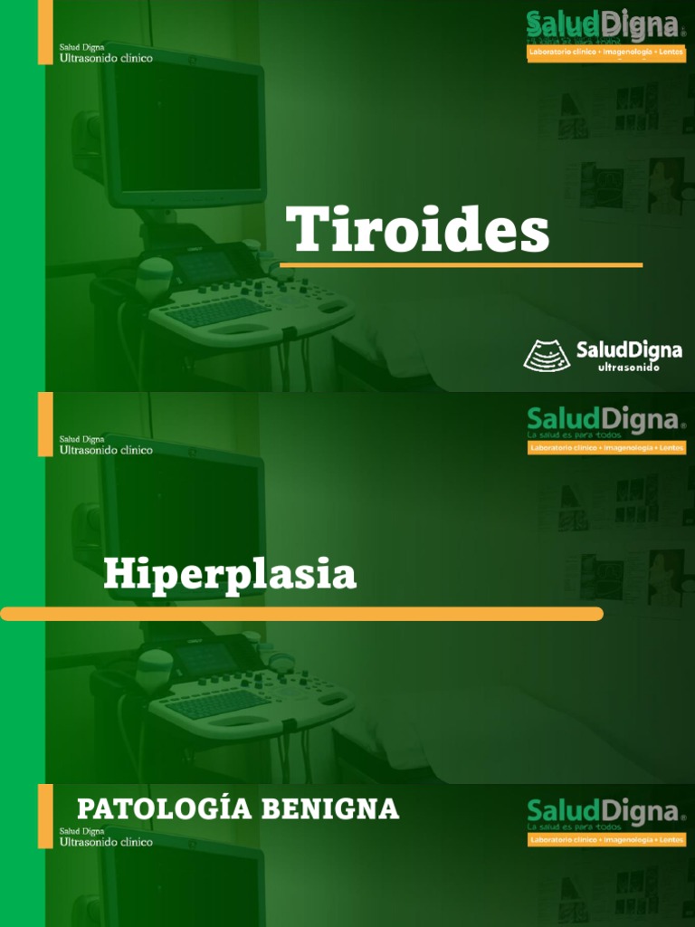 Hiperplasia, Bocio, Adenoma, Tiroiditis | PDF | Hipertiroidismo | Tiroides