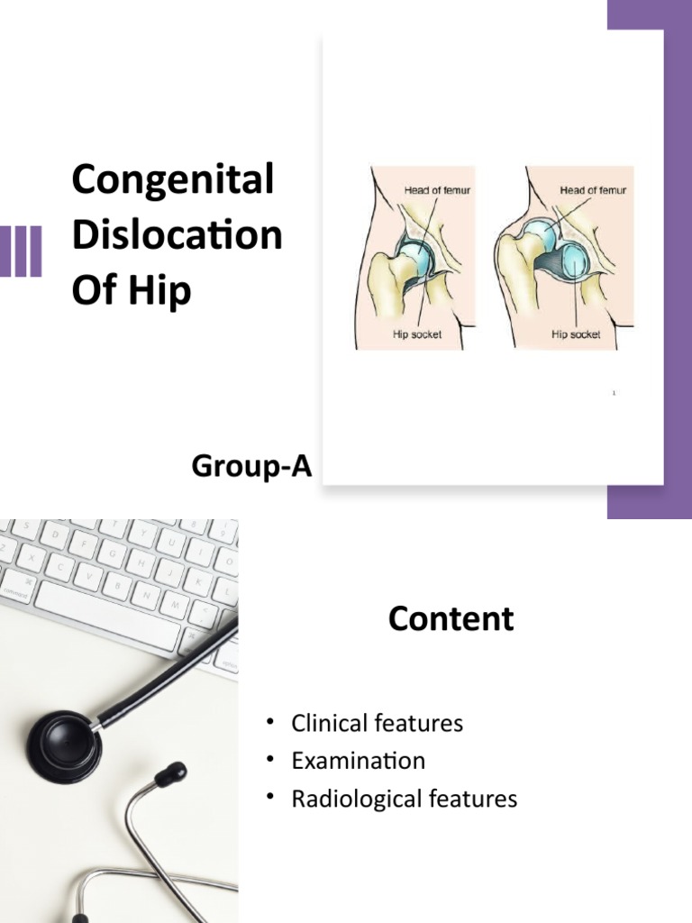 Congenital Dislocation of Hip | PDF