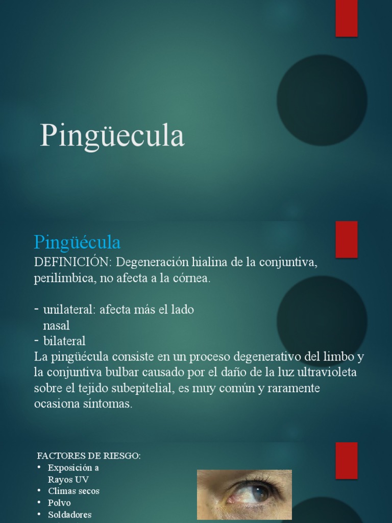 Pinguecula y Pterigion | PDF | Córnea | Ojo humano