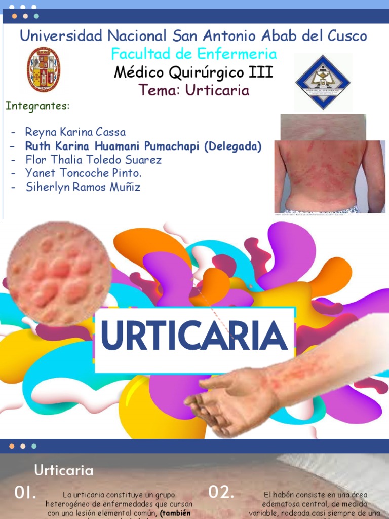 Tema Urticaria | PDF