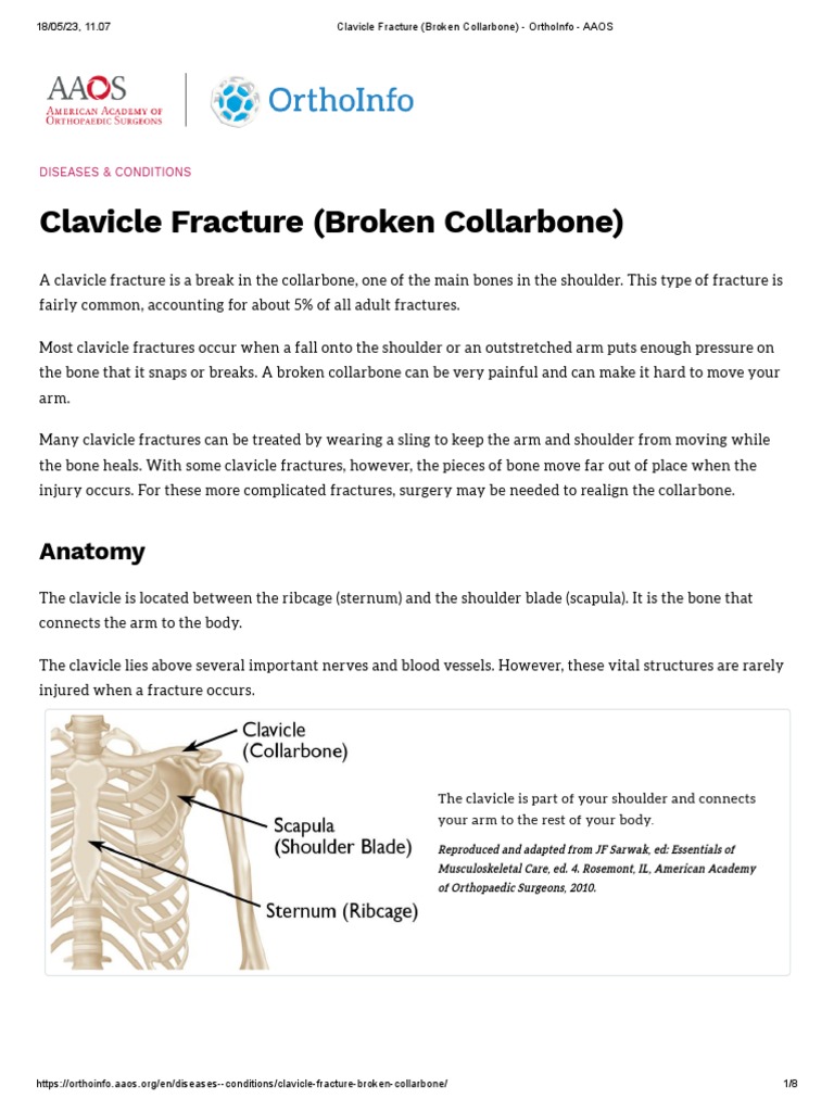 Clavicle Fracture (Broken Collarbone) - OrthoInfo - AAOS | PDF | Injury ... Clavicle Fracture (Broken Collarbone) - OrthoInfo - AAOS | PDF | Injury ...