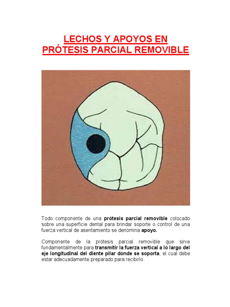 3-PDF Lechos y Apoyos PPR | PDF