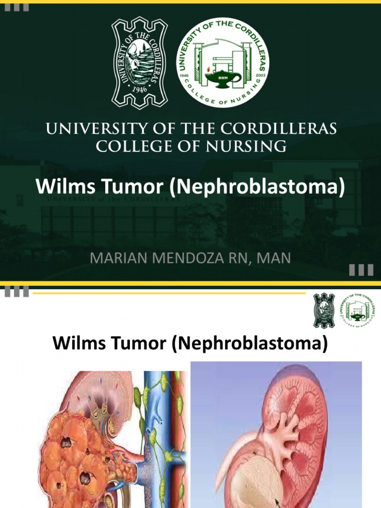 Wilms Tumor | PDF | Kidney | Chemotherapy