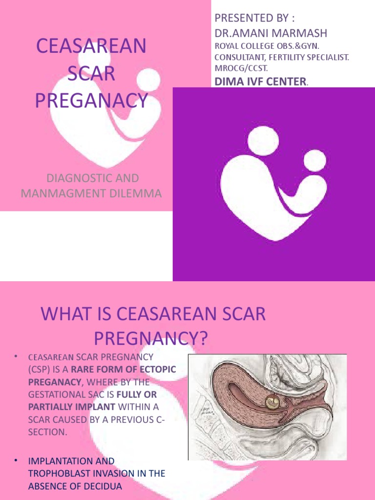 ceasrean-scar-preganacy-2-pdf-uterus-caesarean-section
