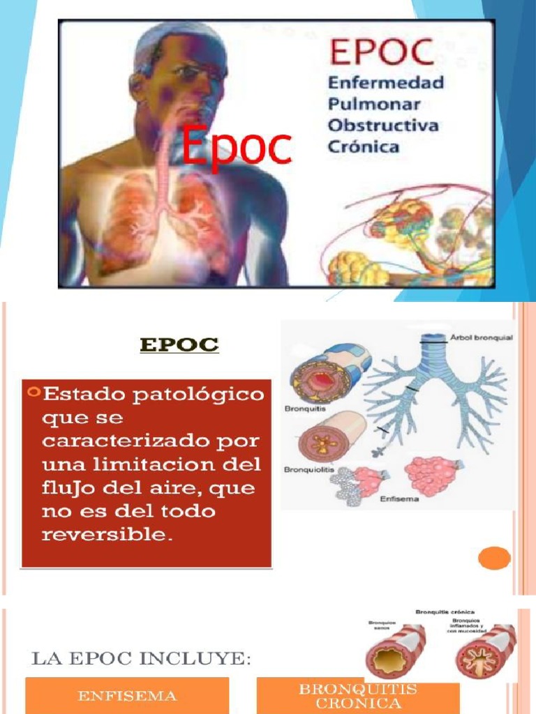 EPOC | PDF