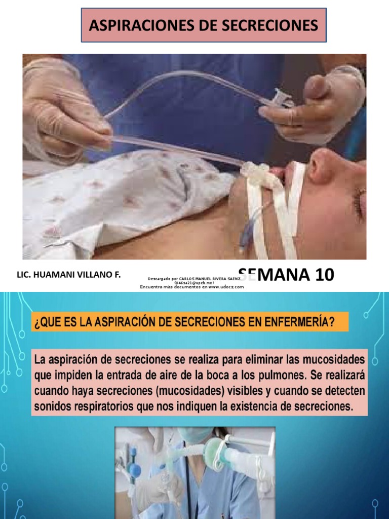 Aspiracion de Secreciones | PDF