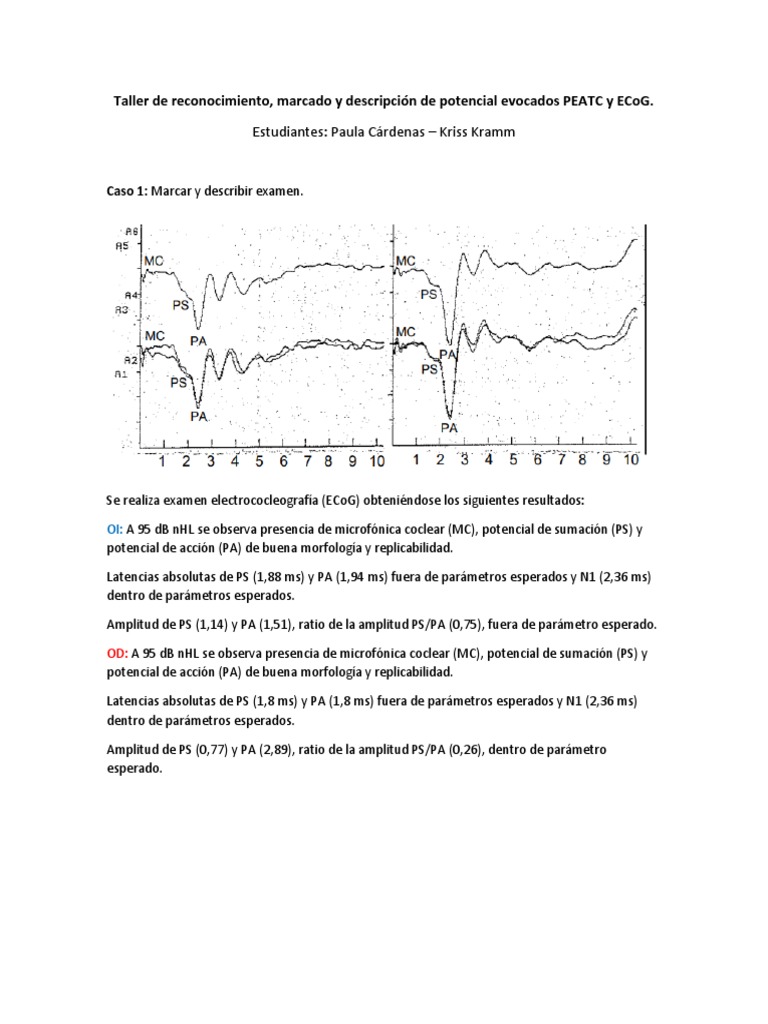 Análisis de Potenciales Evocados Auditivos | PDF | Olas | Decibel