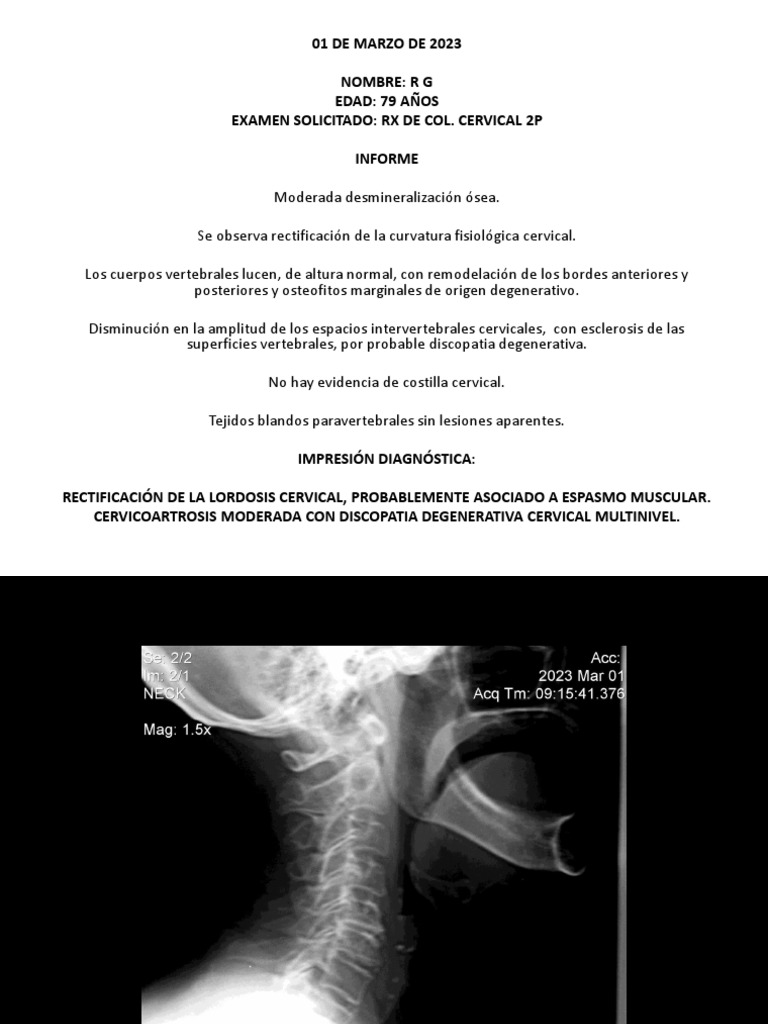 PX RG 79a RX Columna Cervical Discopatia | PDF