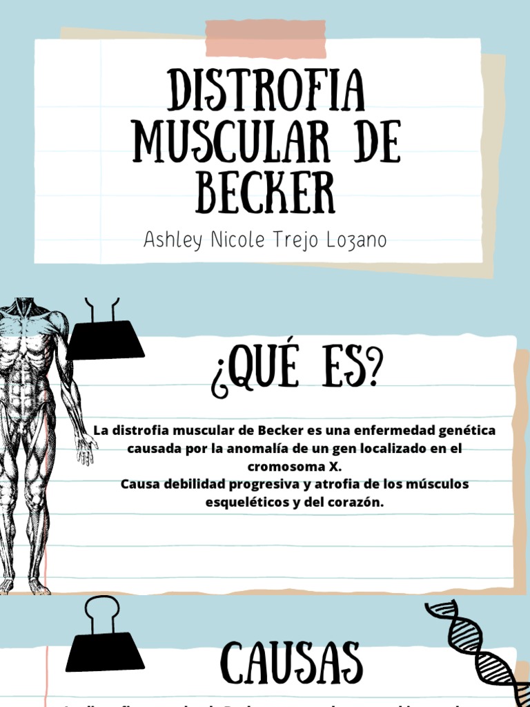 Distrofia Muscular de Becker | PDF