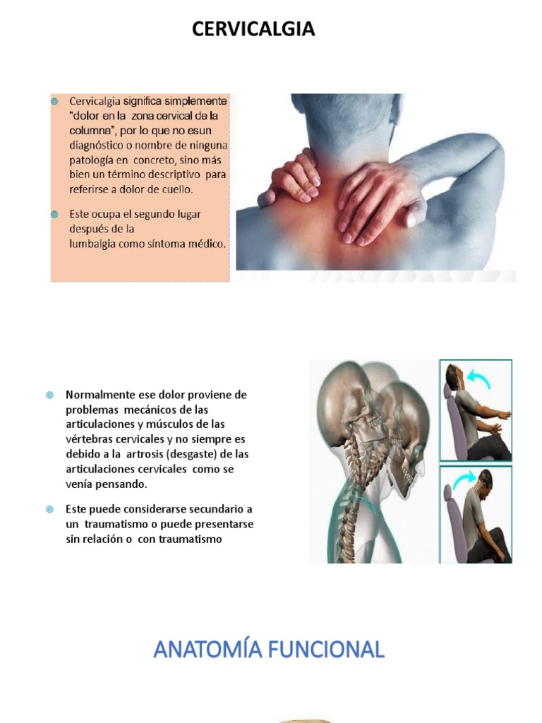 CERVICALGIA | PDF
