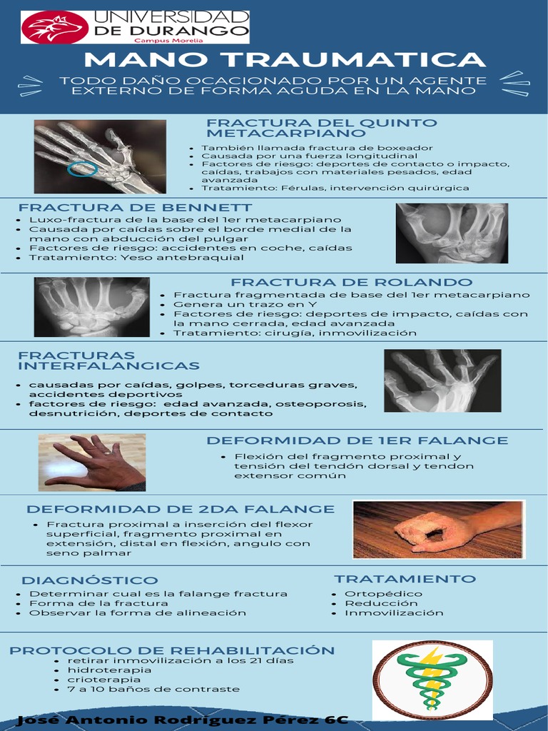 Fracturas en Mano | PDF