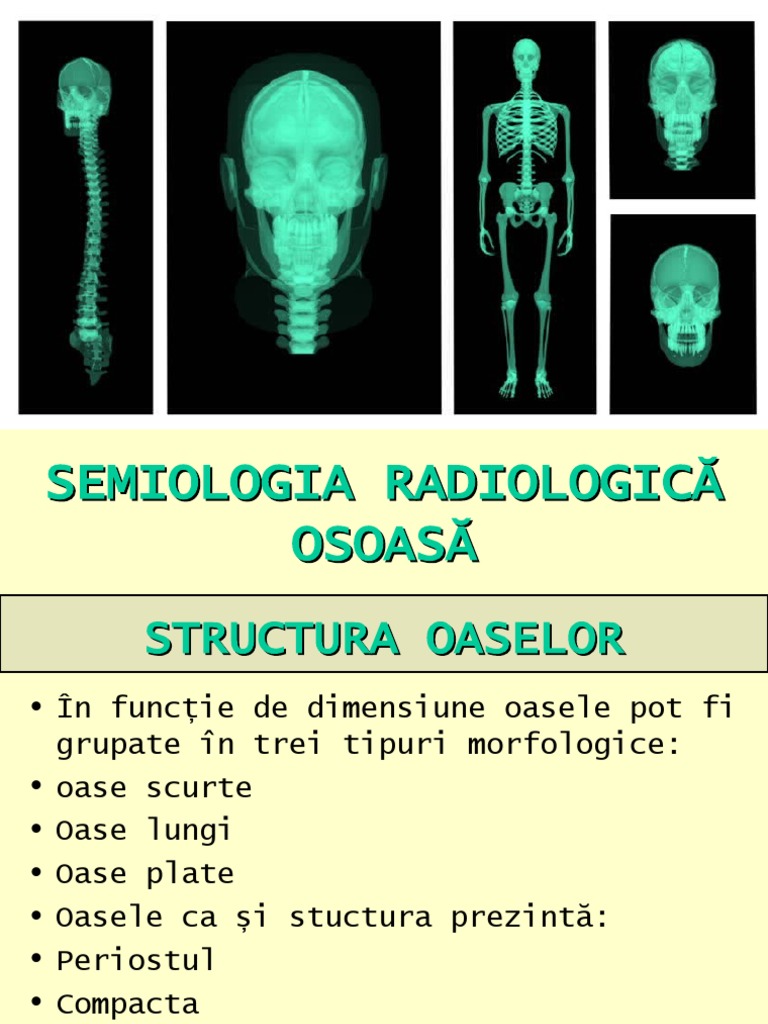SEMILOGIA RADIOLOGICA Osoasa LP | PDF
