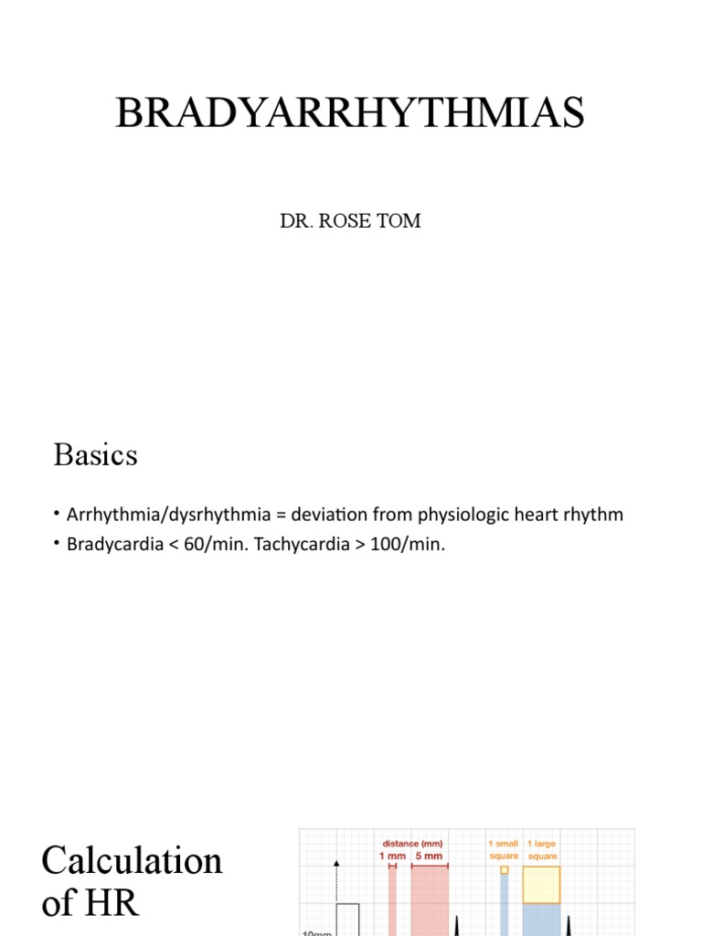 Brady Arrhythmias | PDF | Heart | Electrocardiography
