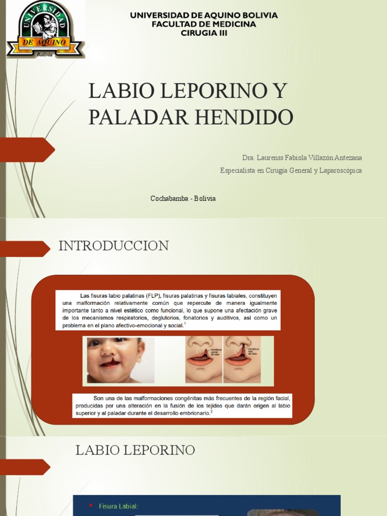 Labio Leporino | PDF