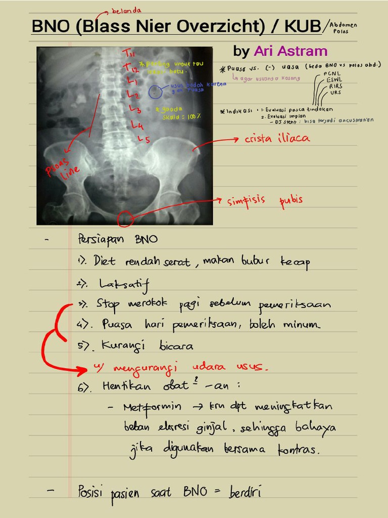 Catatan BNO-IVP | PDF