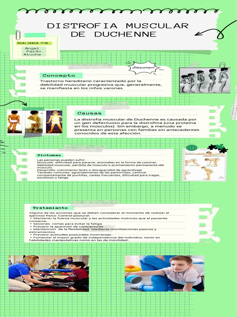 Distrofia Muscular de Duchenne | PDF
