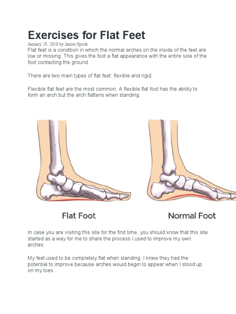 Exercises For Flat Feet | PDF