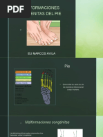 Pie Talo, Pie Varo, Valgo, y Pie Plano | PDF | Pie | Tobillo